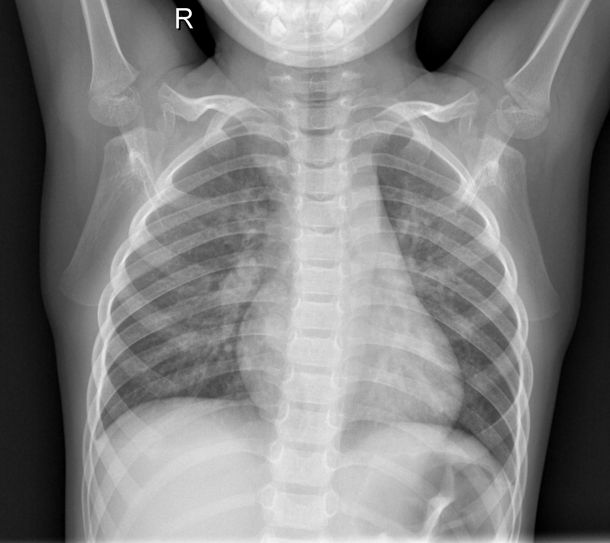 Projects | Liam Haas-Neill